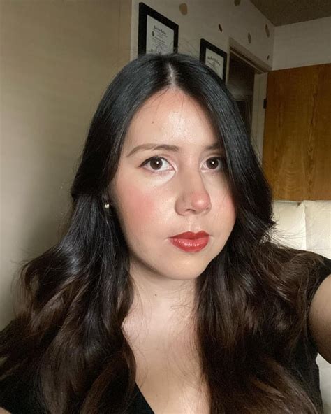 My Major Jaw Glow Up R Jawsurgery