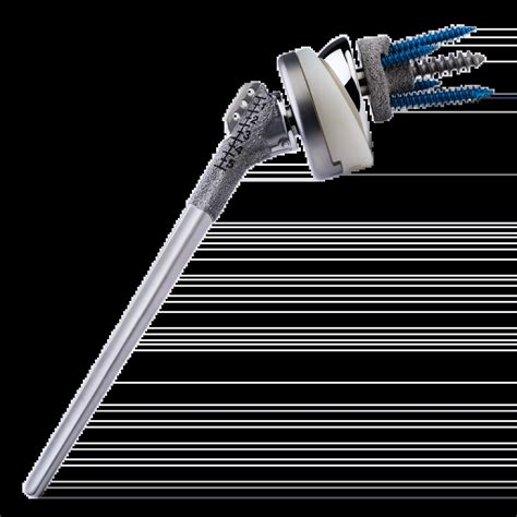 Comprehensive Fracture System Zimmer Biomet