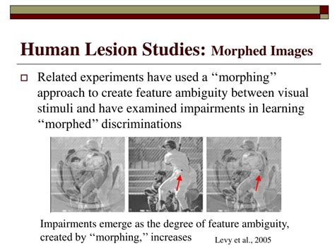 Ppt Involvement Of Medial Temporal Lobe Structures In Memory And