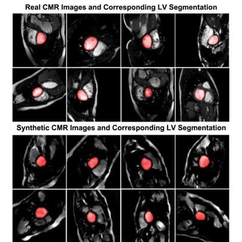 Deep Convolutional Generative Adversarial Network Dcgan Architecture