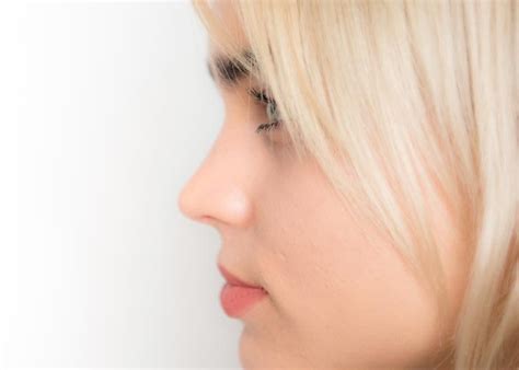 Non Surgical Rhinoplasty Esher Surrey Hava Aesthetics