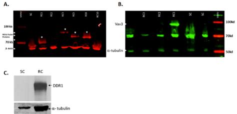 Ros1 And Ddr1 Protein Expression In Gefitinib Resistant Cells To