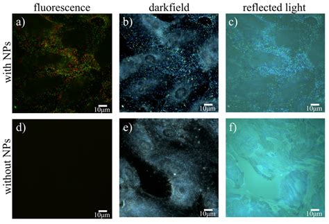 A D Fluorescence B E Darkfield And Cf Reflected Light Image