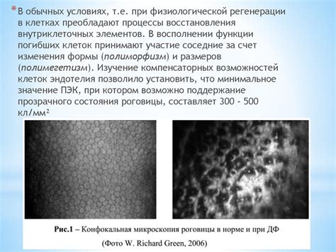 Дистрофии роговицы Эндотелиальная дистрофия роговицы Фукса Online