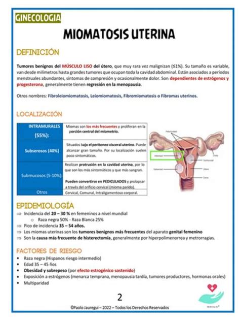 Miomatosis Uterina ANNIETH UDocz
