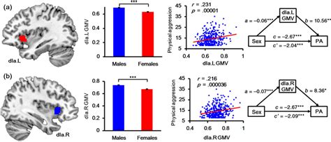 The Results Of Gray Matter Volume Gmv Analyses Of Bilateral Dia Part