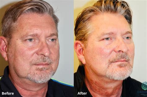 Best Plastic Surgery Atlanta Ga Radiance Surgery And Aesthetic Medicine