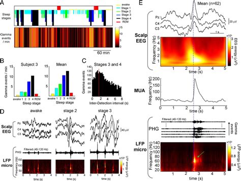 Gamma And Scalp Eeg Patterns During Polysomnographically Defined Download Scientific Diagram