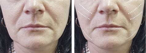 Do Jowl Exercises Really Work Best Moves For A Firmer Jawline