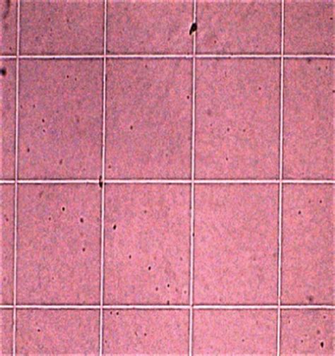 Hemocytometer Field Image 40× Of Leukocytes In Balf Dilution Factor Download Scientific