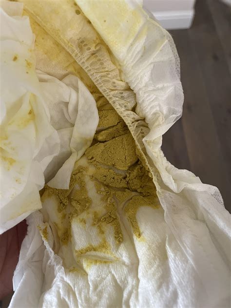 Normal Stool R Newborns