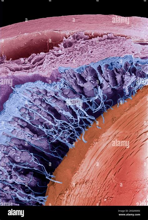 Iris Of The Eye Coloured Scanning Electron Micrograph Sem Of The