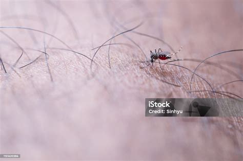 클로즈 업 애 데 아 이집트 티 인간의 피부에 일반적인 집 모기 혈액 인간을 빠는 애 들 이집트 티 가득 찬에 대한 스톡 사진