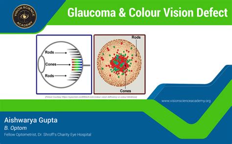 Glaucoma And Colour Vision Defect Vision Science Academy