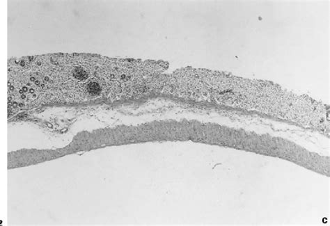 Figure 3 From Lessons From Experimental Colitis Models Semantic Scholar