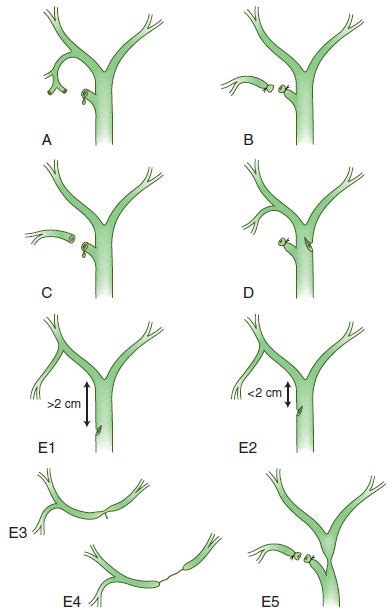 Surgicalcore Tablefigure