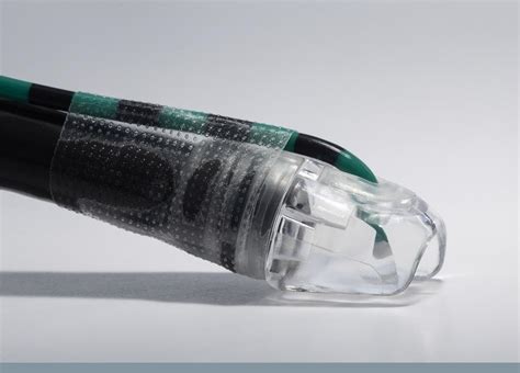 Ovesco Endoscopy Ag Argocap™ Promising Results For Facilitation Of