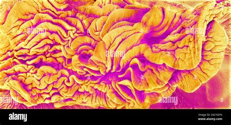 Fimbriae Of A Fallopian Tube Coloured Scanning Electron Micrograph SEM Fimbriae Are The