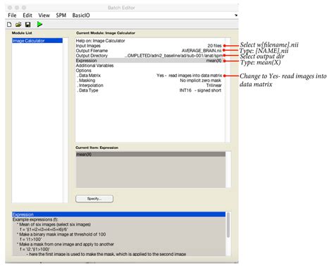 Analysis Spm Documentation