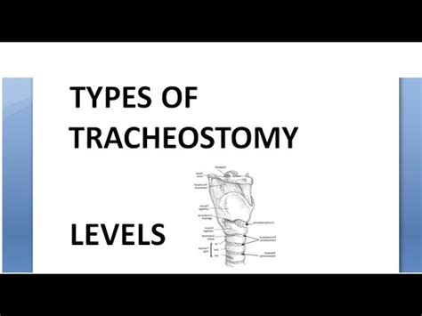 Cricothyrotomy Vs Tracheostomy