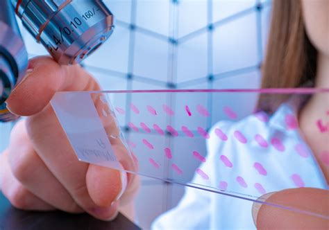 Anatomic Pathology Analyze Pathology