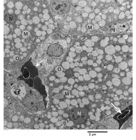 Transmission Electron Micrograph Of The Hepatocyte Of Chicks Download Scientific Diagram