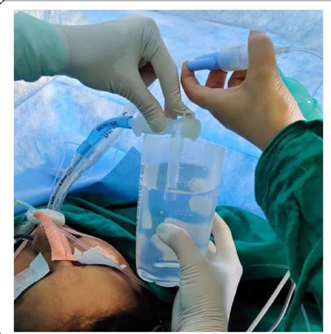 Checking For Adequate Seal By Water Bubble Method Download Scientific