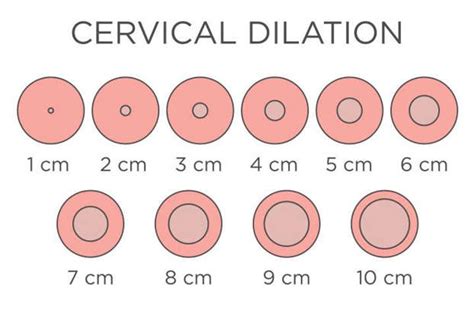 Cervix Dilation Chart Signs Stages And Procedure To Check