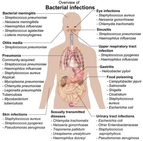 Staphylococcus Aureus Infection Symptoms