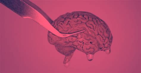 49 Interesting Human Brain Facts And Stories