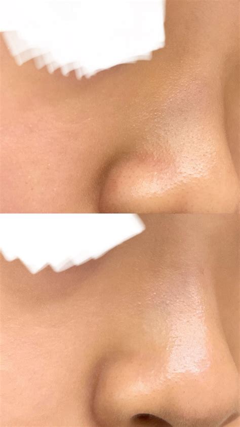 피부타입 중성 건성 지성 지식in
