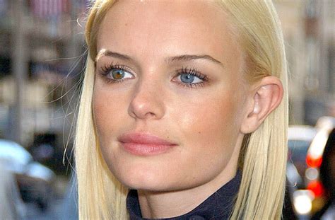 Demi Moore Heterochromia