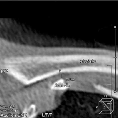 Figure 1 From The Use Of Four Dimensional Computed Tomography To