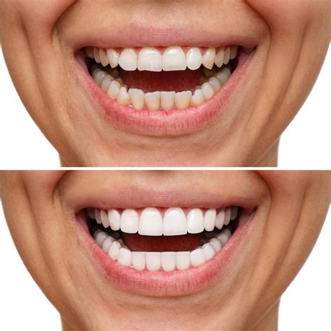 Premium Photo Cropped Shot Of Young Caucasian Smiling Woman Before