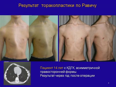 Thorax Титульная страница Презентация доклада Хирургическое