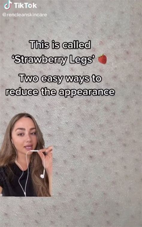 Skincare Expert On Why You Get ‘strawberry Legs After Shaving And How To