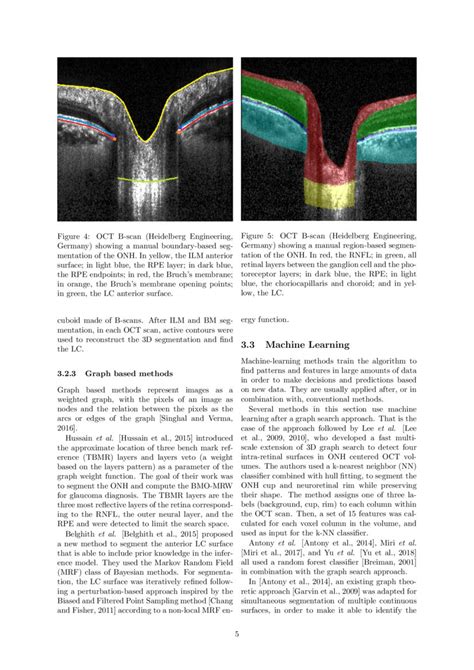 Automatic Segmentation Of The Optic Nerve Head Region In Optical Coherence Tomography A