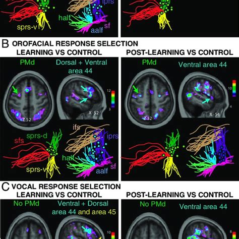 Functional Dissociations In The Posterior Lateral Frontal Cortex During Download Scientific