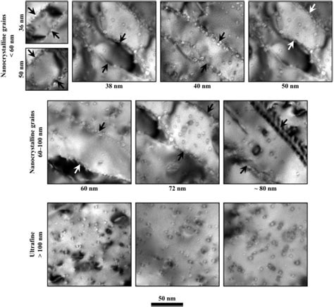 Scale Marker Applies To All Micrographs Download Scientific Diagram