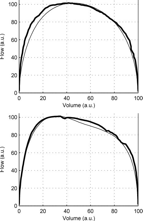 Figure 1 From Tidal Breathing Flow Volume Curves With Impedance Pneumography During Expiratory