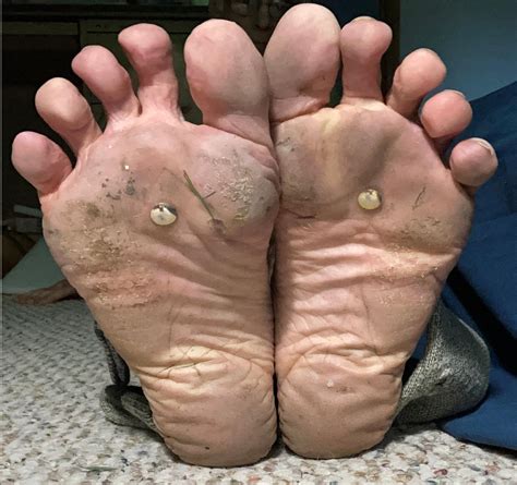 Bare Feet With Tacks By Cr 1103 On Deviantart