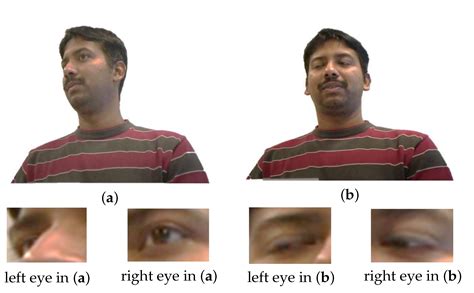 Gaze Estimation Approach Using Deep Differential Residual Network