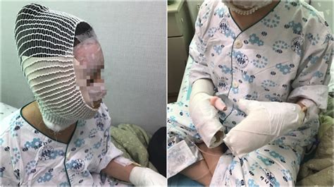 손도 쓸 수 없는데”···‘부산 목욕탕 화재 피해 경찰관에 동료들 모금