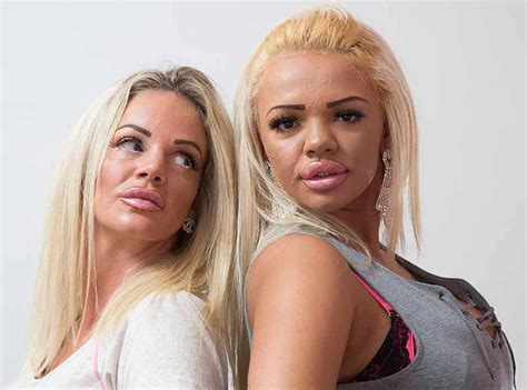 Mom Daughter Duo Drop 80000 On Plastic Surgery Together