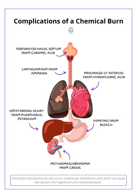 Chemical Burns · Types Complications Management