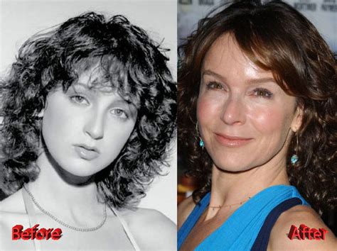 Jennifer Grey Nose Job Disaster Plastic Surgery Mistakes