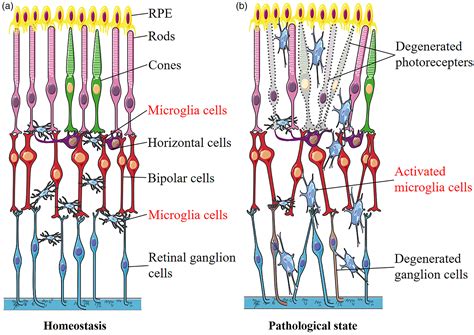 Retinal Microglia Functions And Diseases Fan 2022 Immunology