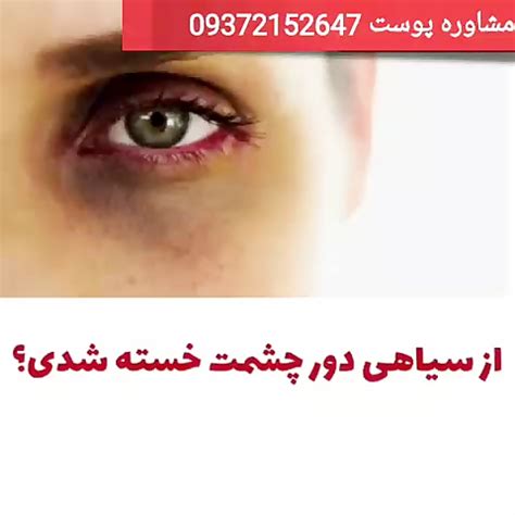 کرم لازان از بین برنده کامل جای جوش