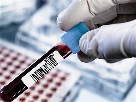 Rheumatoid Factor Cpt Code