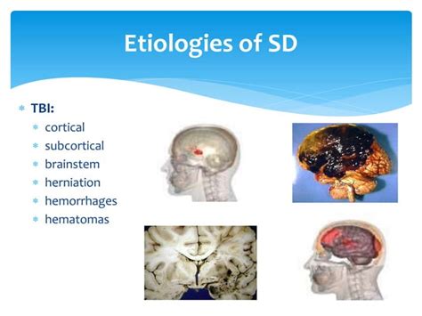 Dysarthria Lecture For Recordinpptx